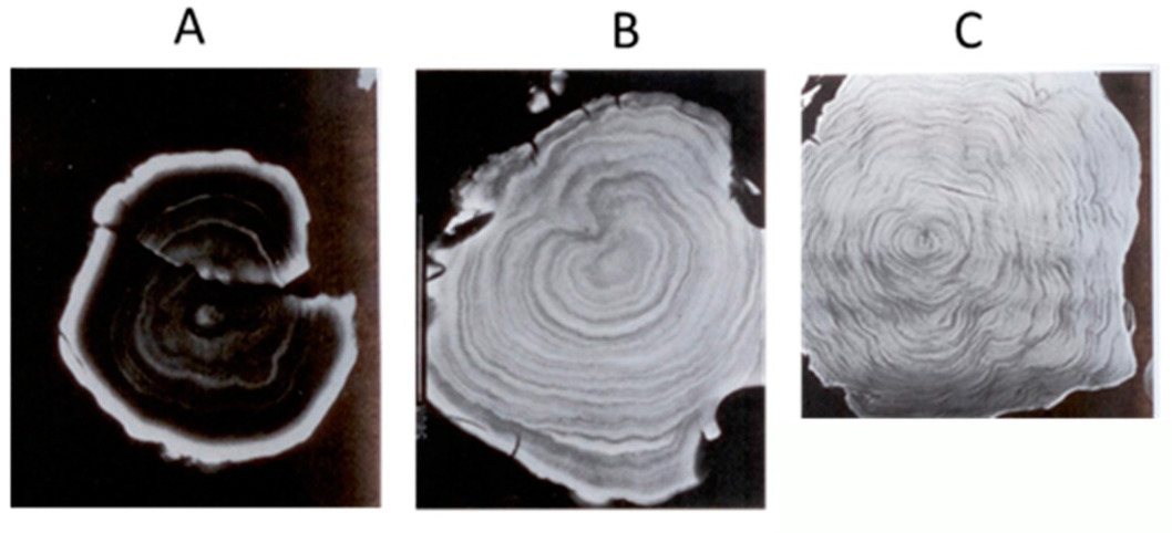The Pineal Gland: Everything about the mysterious part of the brain and ...